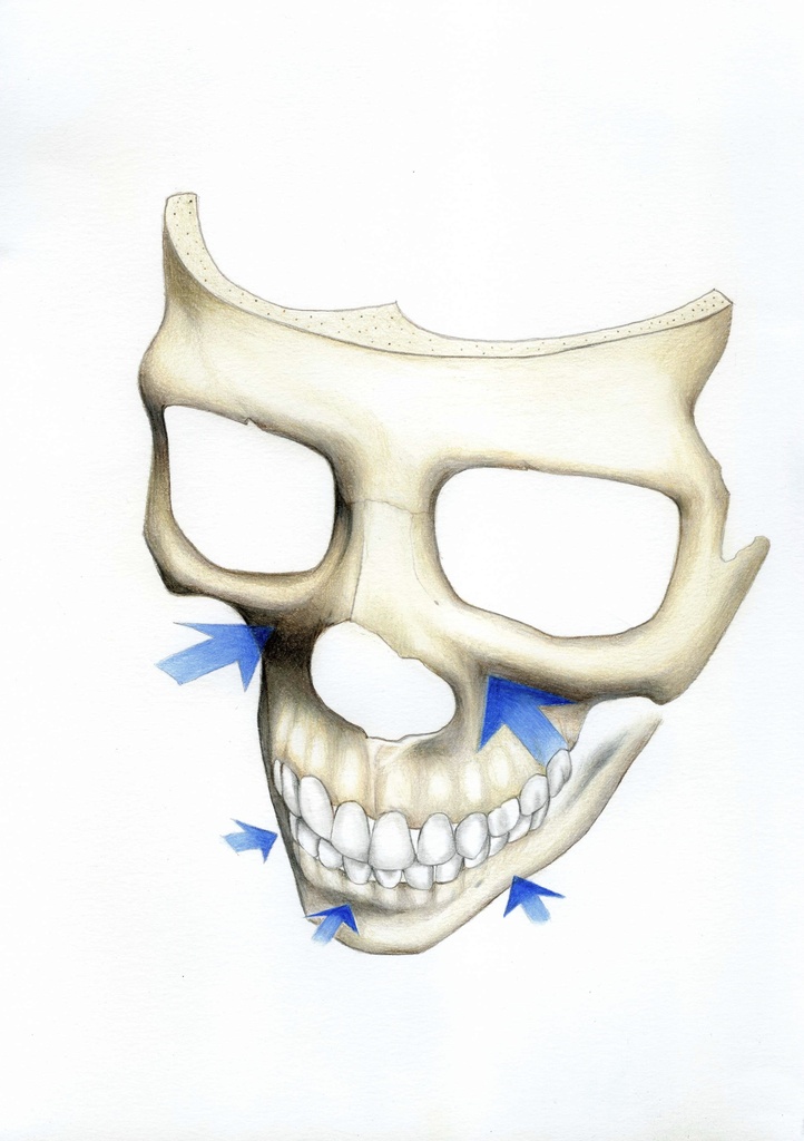 Facelift Science | Deep Plane Facelift Surgeon London UK