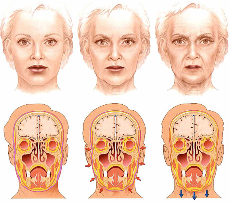 Facelift Artistry | Best Facelift Surgeon London UK | Rajiv Grover