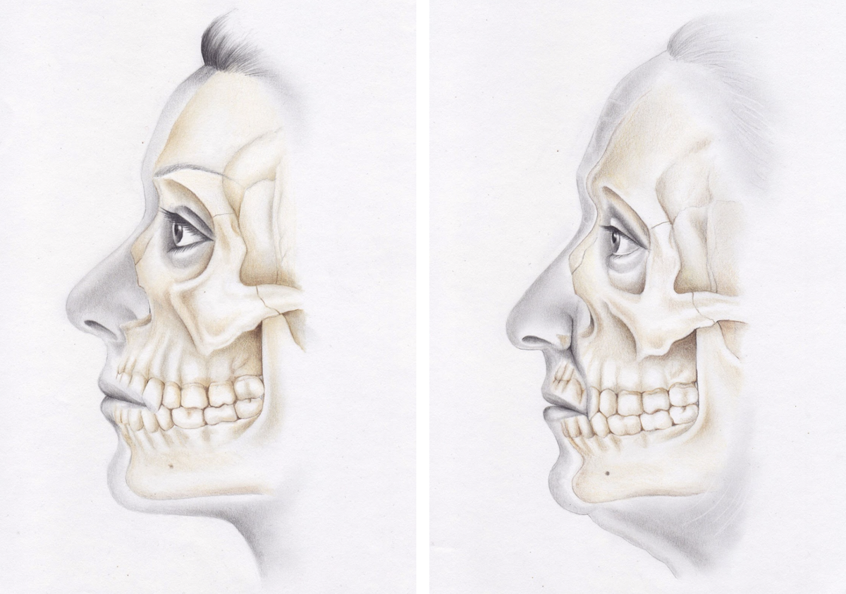 Facelift Science | Deep Plane Facelift Surgeon London UK